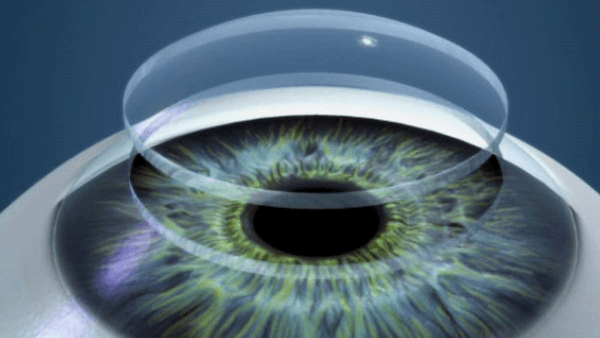 Scientists Create the First 3D Printed Cornea Using Stem Cells